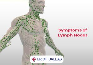 Lymph Nodes: Symptoms, Causes, Types, and More - ER of Dallas ...